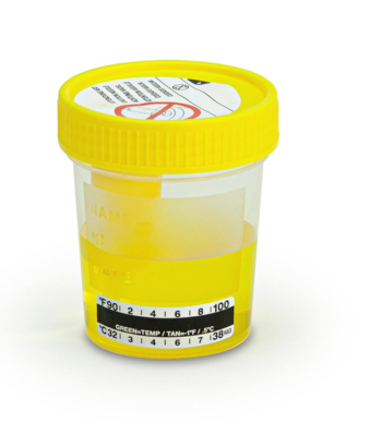 TransferTop™ Urine Transfer Products | KLM Bio Scientific