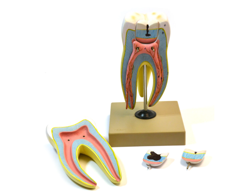 Human Upper Triple Root Molar with interchangeable cavities – 6 parts ...