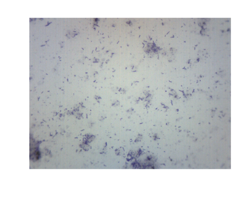 Bacteria from Mouth – Prepared Microscope Slide – 75x25mm | KLM Bio ...