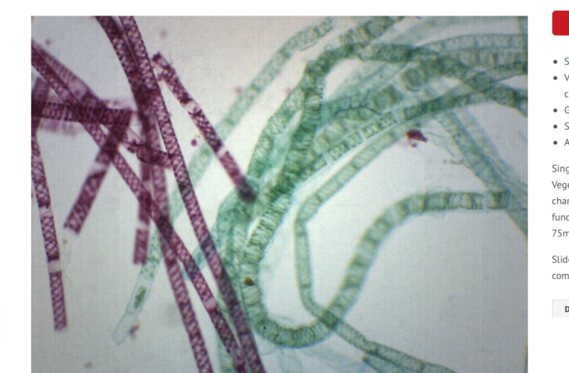 Vegetative Spirogyra – Prepared Microscope Slide – 75x25mm | KLM Bio ...