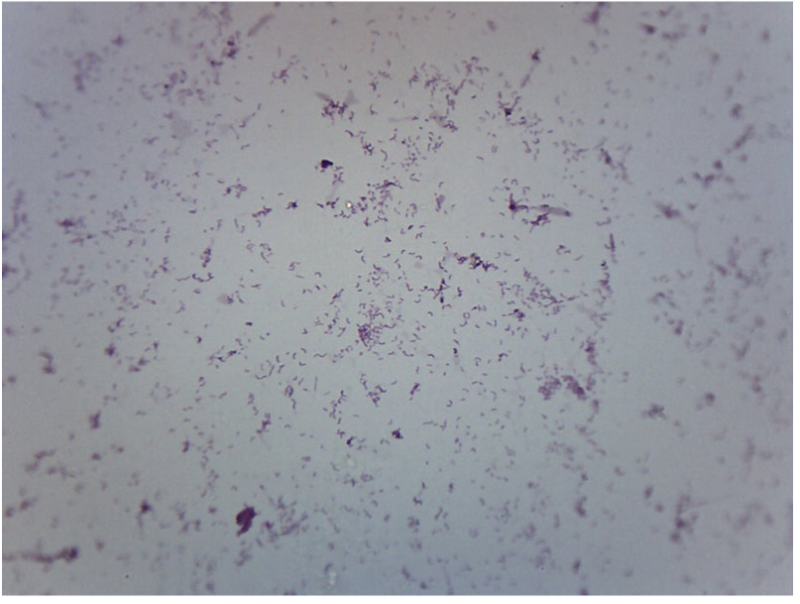 Vibrio Cholerae Smear – Prepared Microscope Slide – 75x25mm | KLM Bio ...