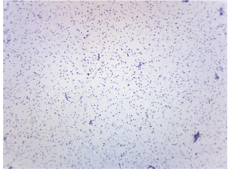 Staphylococcus Aureus – Gram Pos. – Prepared Microscope Slide – 75x25mm ...