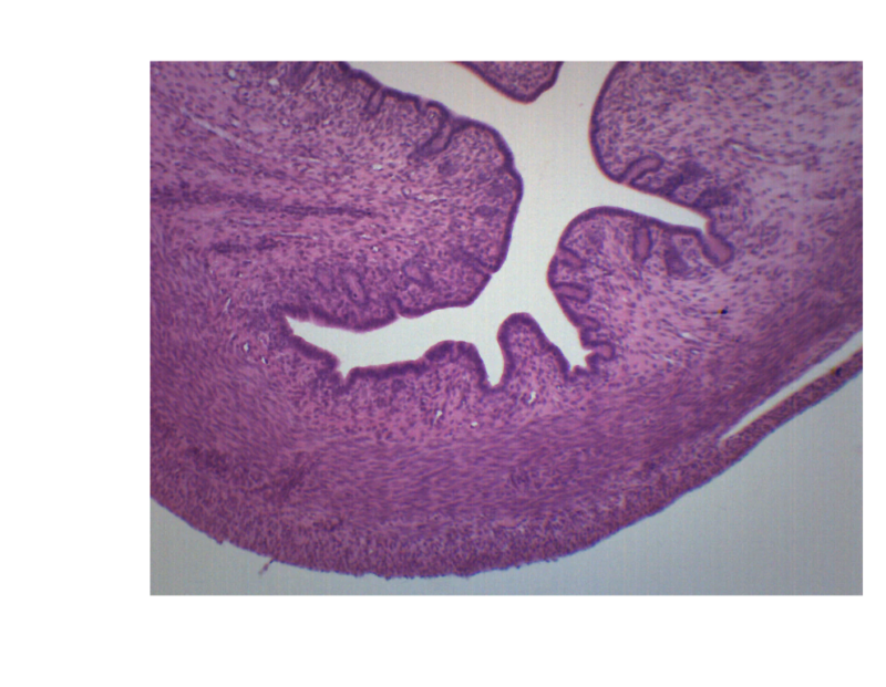 Female Uterus – Prepared Microscope Slide – 75x25mm (EACH) | KLM Bio ...