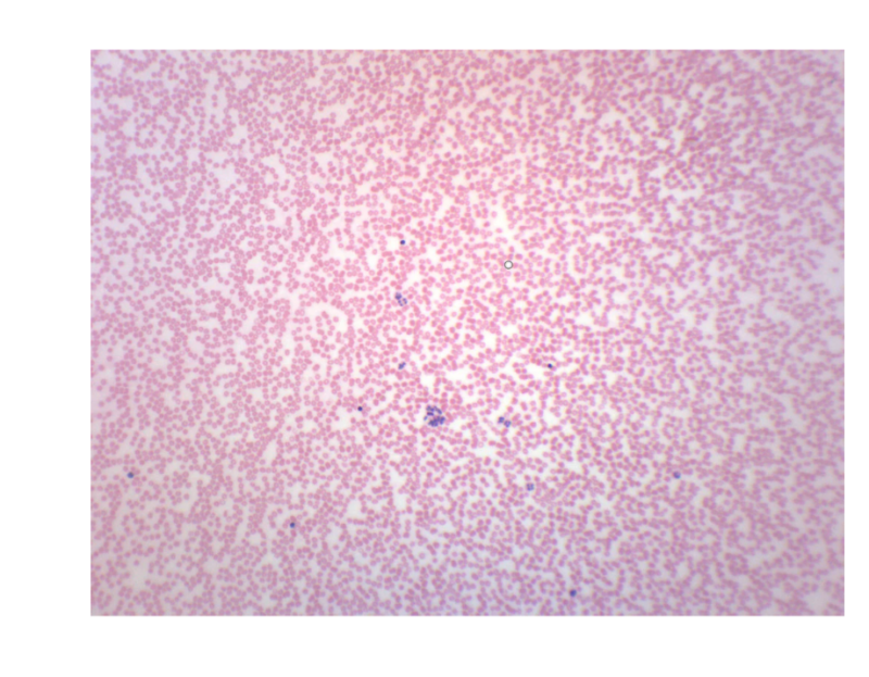 Human Blood Smear (HE Stain) – Prepared Microscope Slide – 75x25mm ...