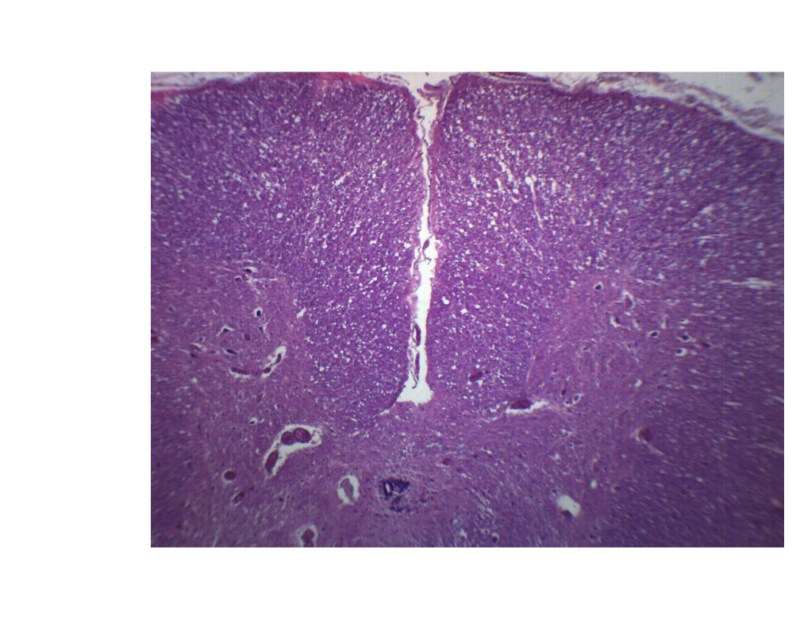 Cervical Spinal Cord, Human – Cross Section – Prepared Microscope Slide ...
